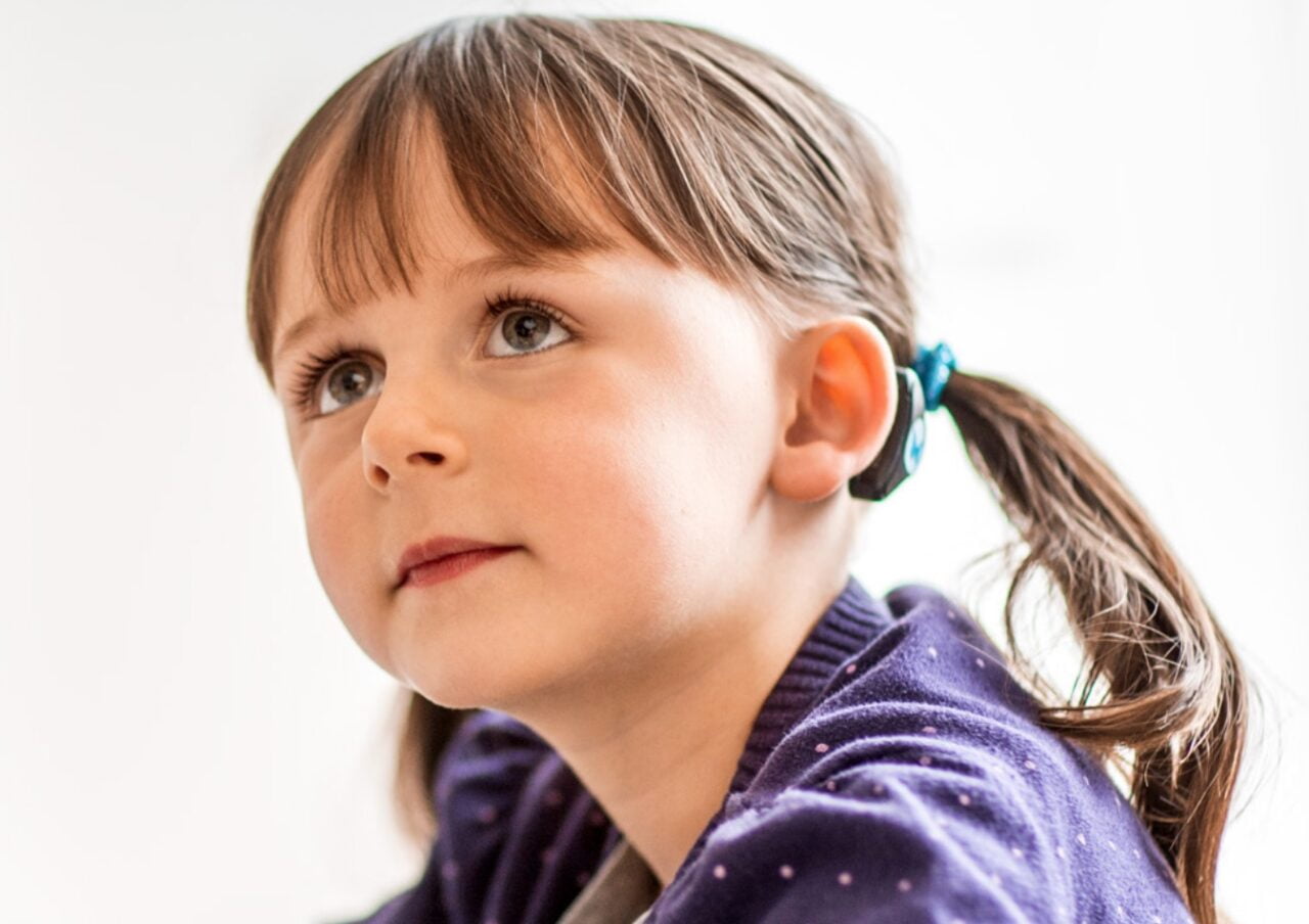 ADHEAR Bone Conduction Hearing System - HearMed